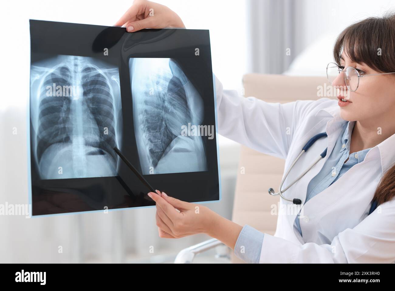 Lung disease. Doctor examining chest x-ray in clinic Stock Photo - Alamy