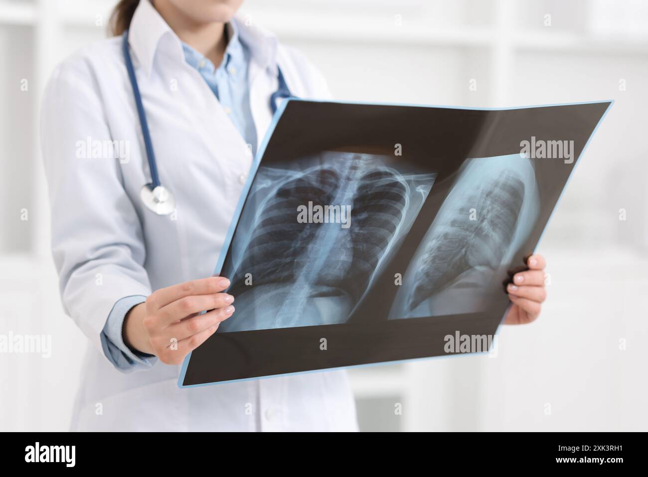 Lung disease. Doctor examining chest x-ray in clinic, closeup Stock ...