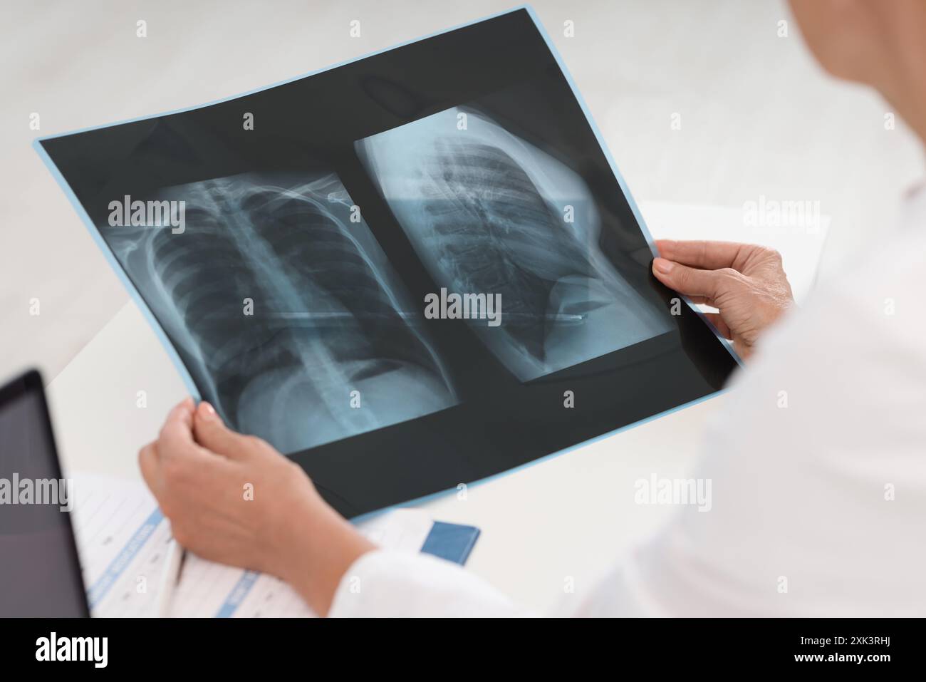 Lung disease. Doctor examining chest x-ray in clinic, closeup Stock ...