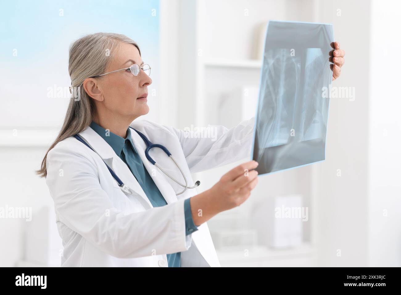 Lung disease. Doctor examining chest x-ray in clinic Stock Photo - Alamy