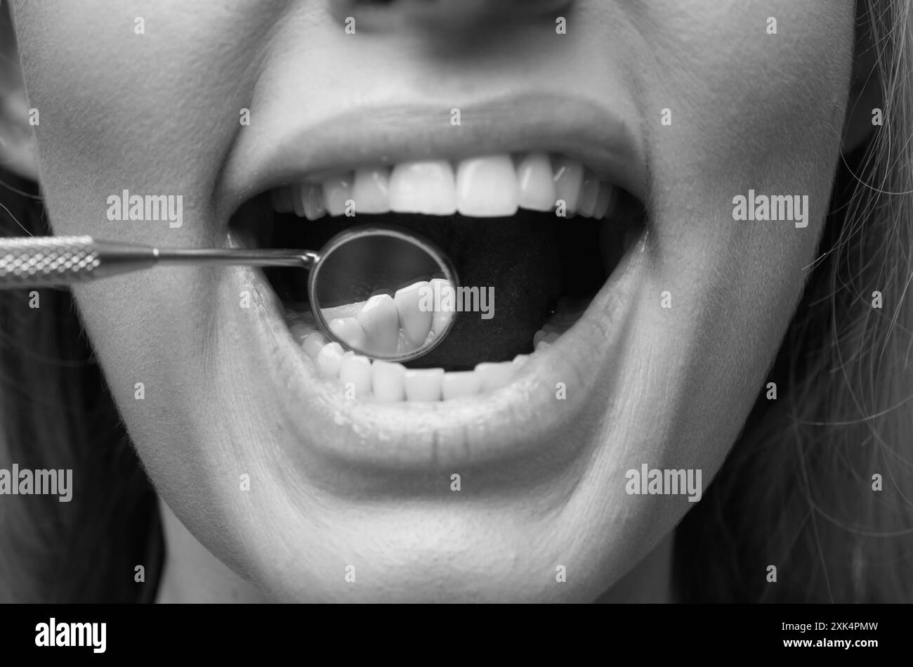 Examination of teeth with dental mirror. Dental and oral hygiene ...