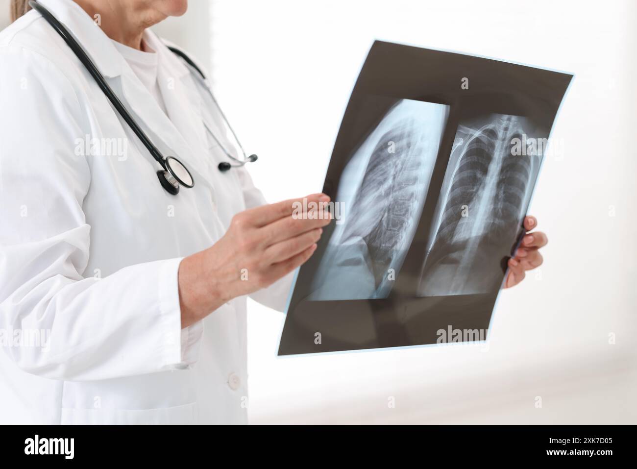 Lung disease. Doctor examining chest x-ray in clinic, closeup Stock ...