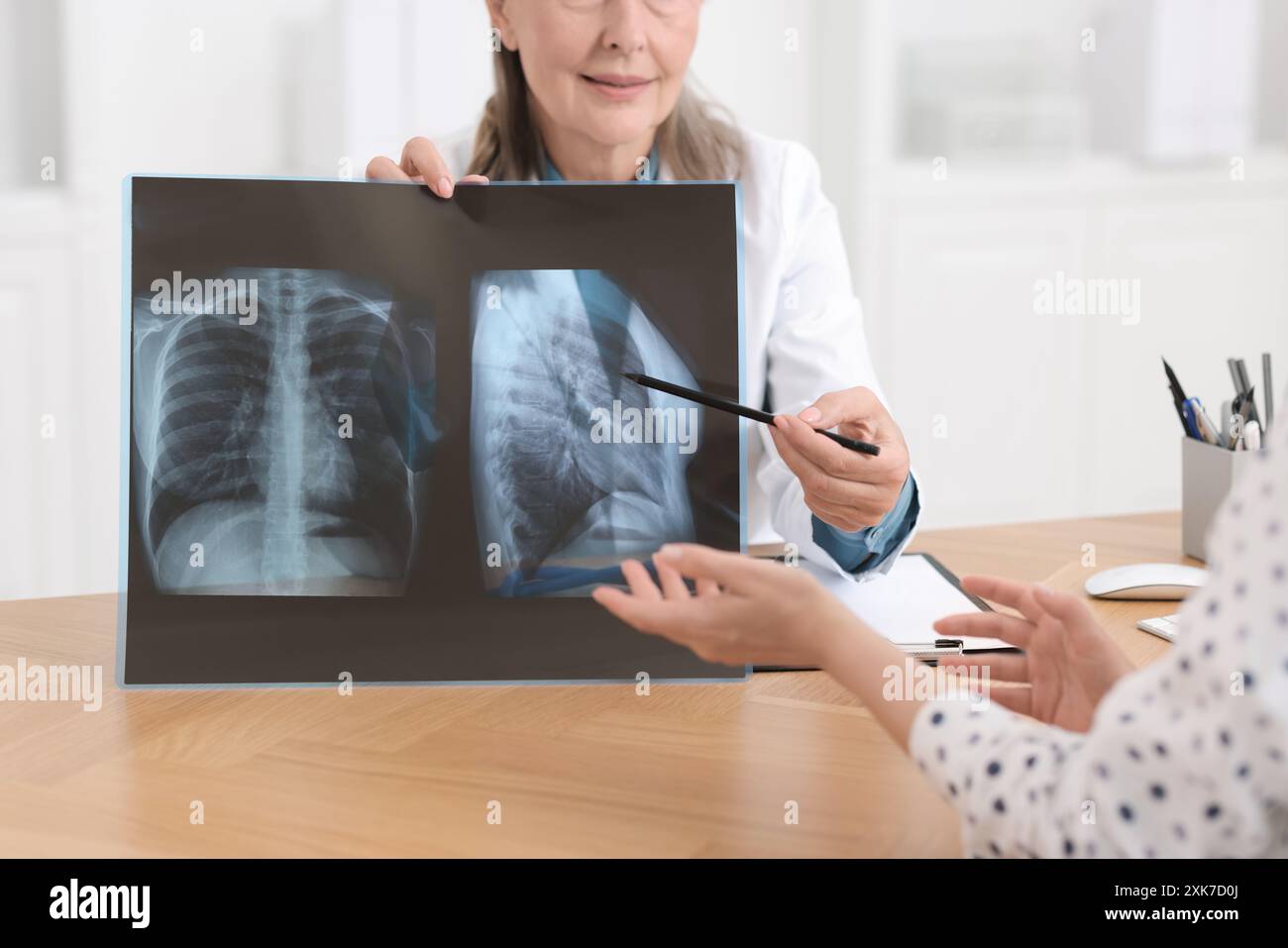 Lung disease. Doctor showing chest x-ray to her patient in clinic ...