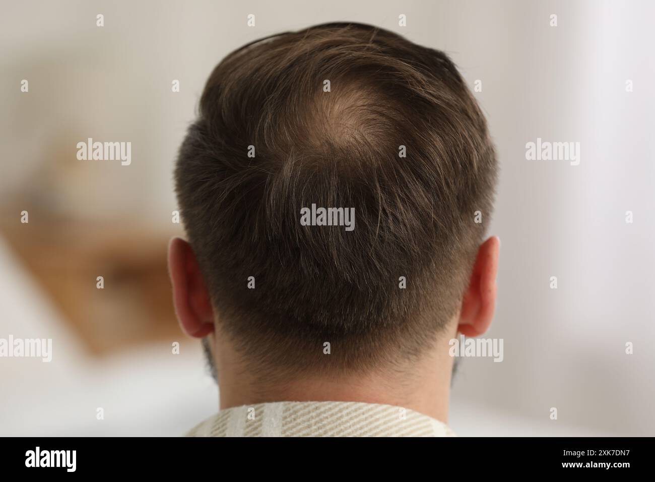 Baldness concept. Man with bald spot indoors, back view Stock Photo - Alamy