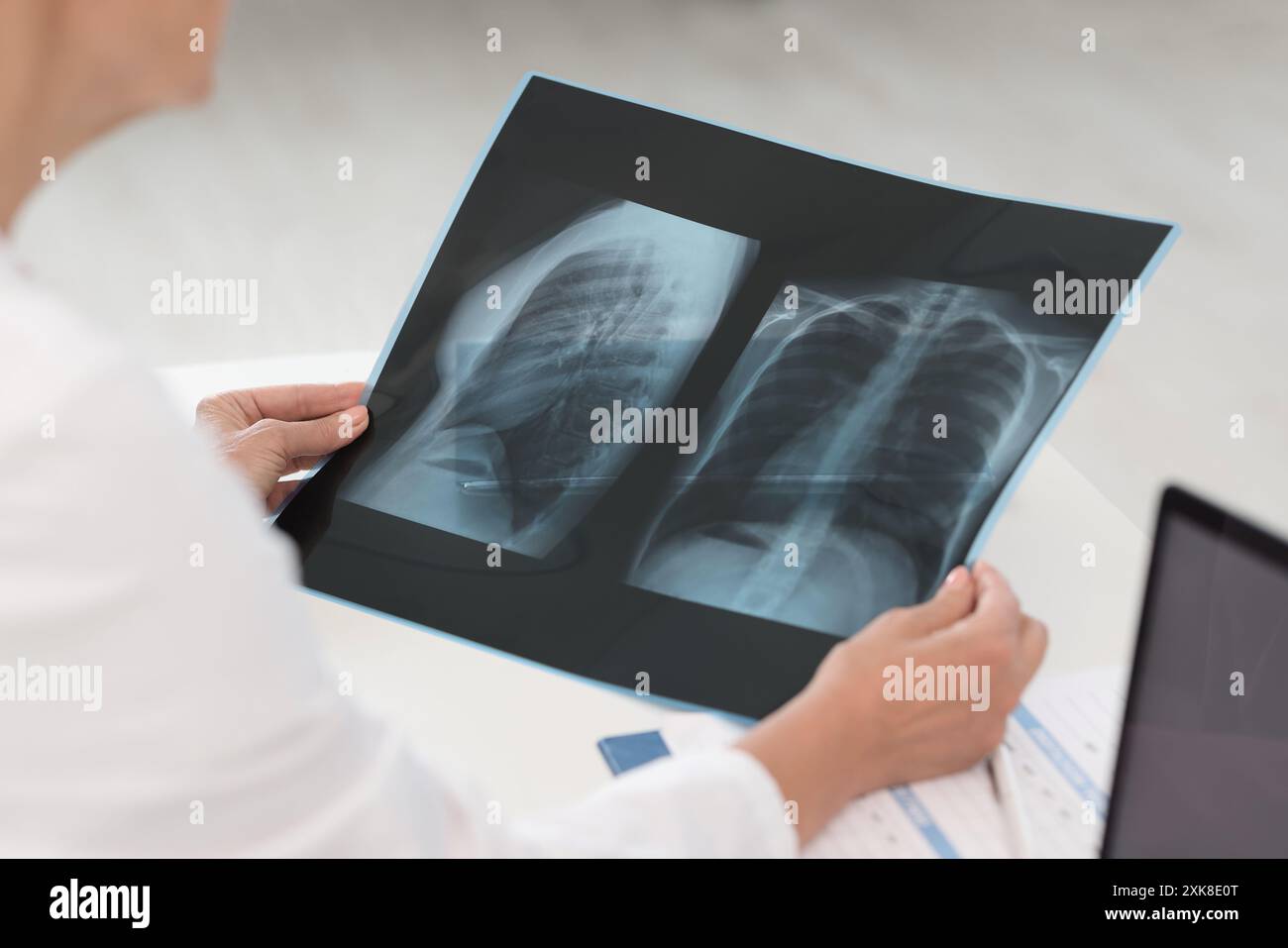 Lung disease. Doctor examining chest x-ray in clinic, closeup Stock ...