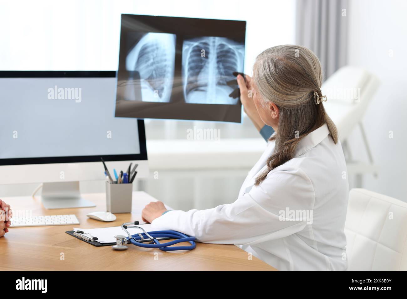 Lung disease. Doctor examining chest x-ray in clinic Stock Photo - Alamy