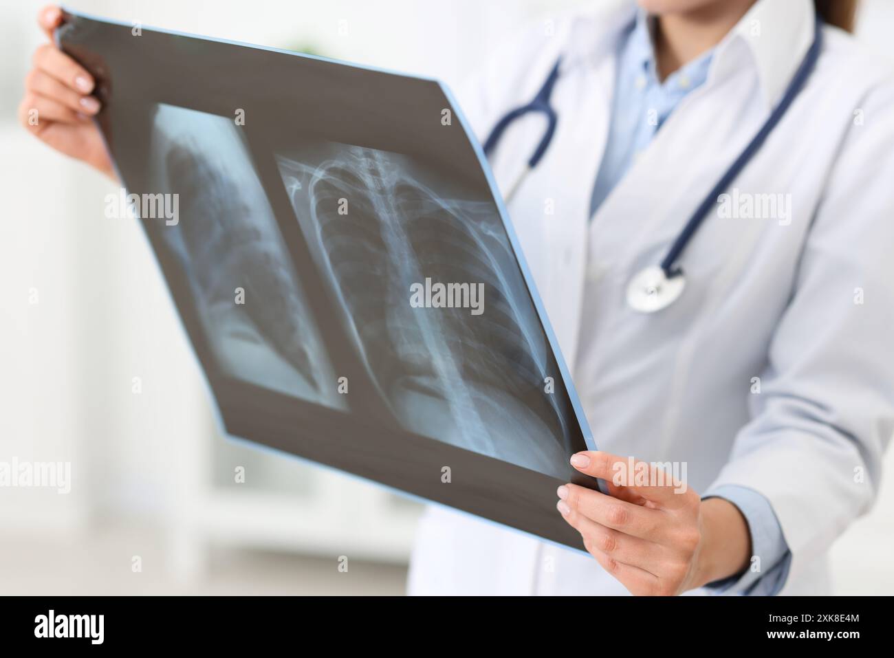 Lung disease. Doctor examining chest x-ray in clinic, closeup Stock ...