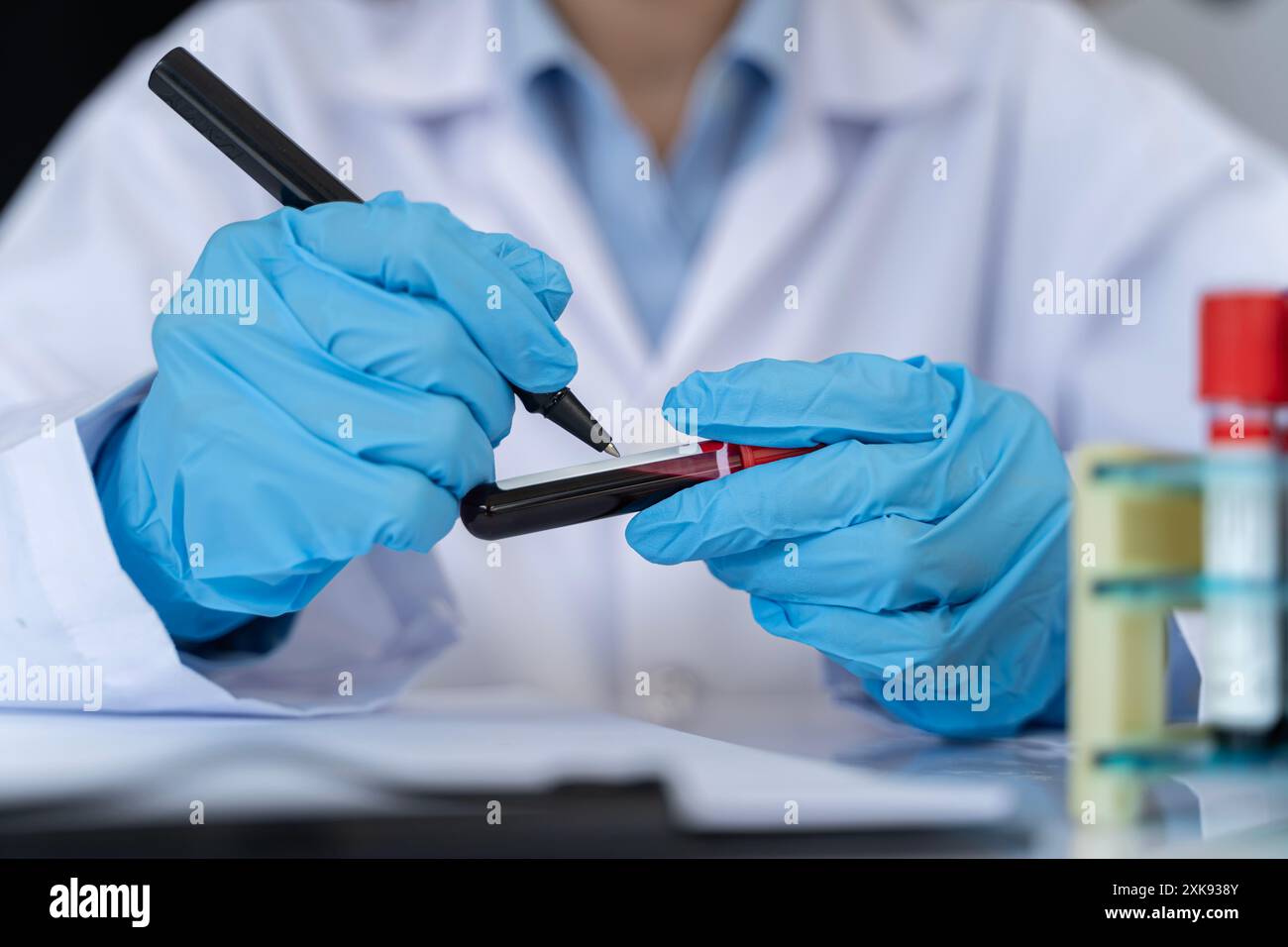 Woman working with a blood sample in the laboratory. Doctor's hand ...
