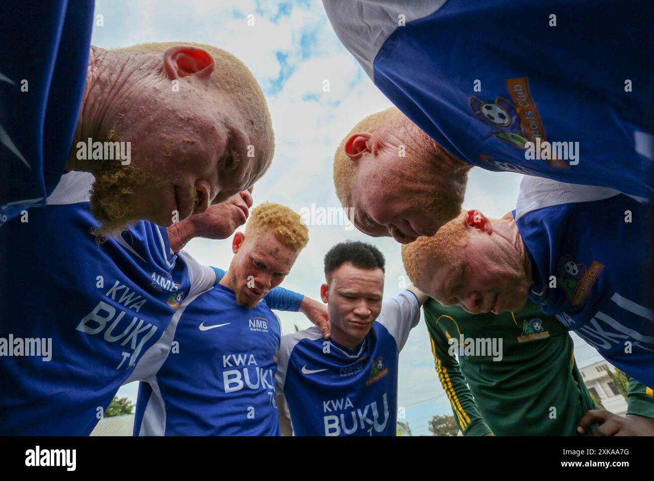 Dar Es Salaam, Tanzania. 20th July, 2024. Players of Albinism Sports ...