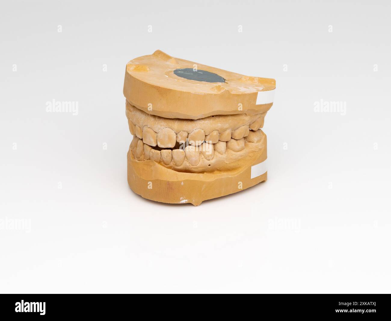 Dental model after a teeth imprint or impression. Technology at a ...