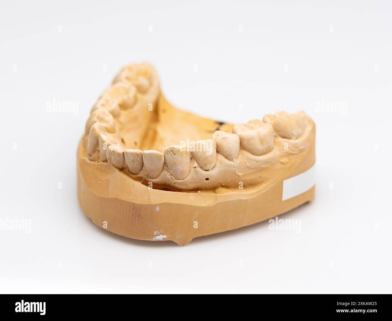 Lower row of teeth dental model. Cast of an imprint done by a dentist ...
