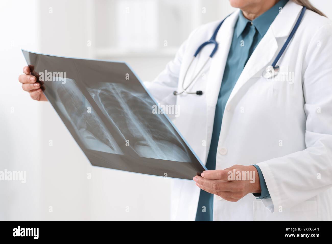 Lung disease. Doctor examining chest x-ray in clinic, closeup Stock ...