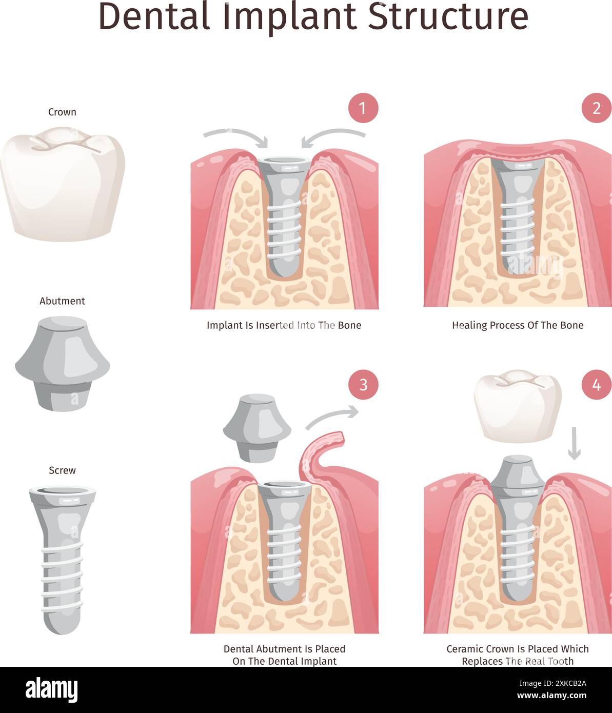 Screw anatomy Cut Out Stock Images & Pictures - Alamy