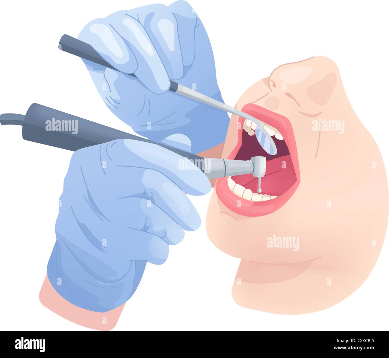 Dentist hands drill teeth. Dental surgery, stomatologist hands in ...