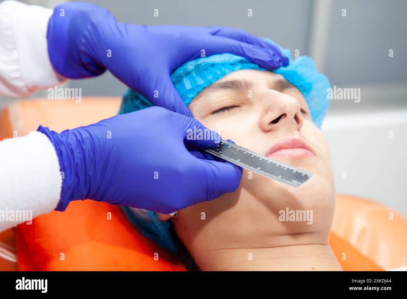 Skin lesion removal procedure. Dermatologist carrying out a removal of ...