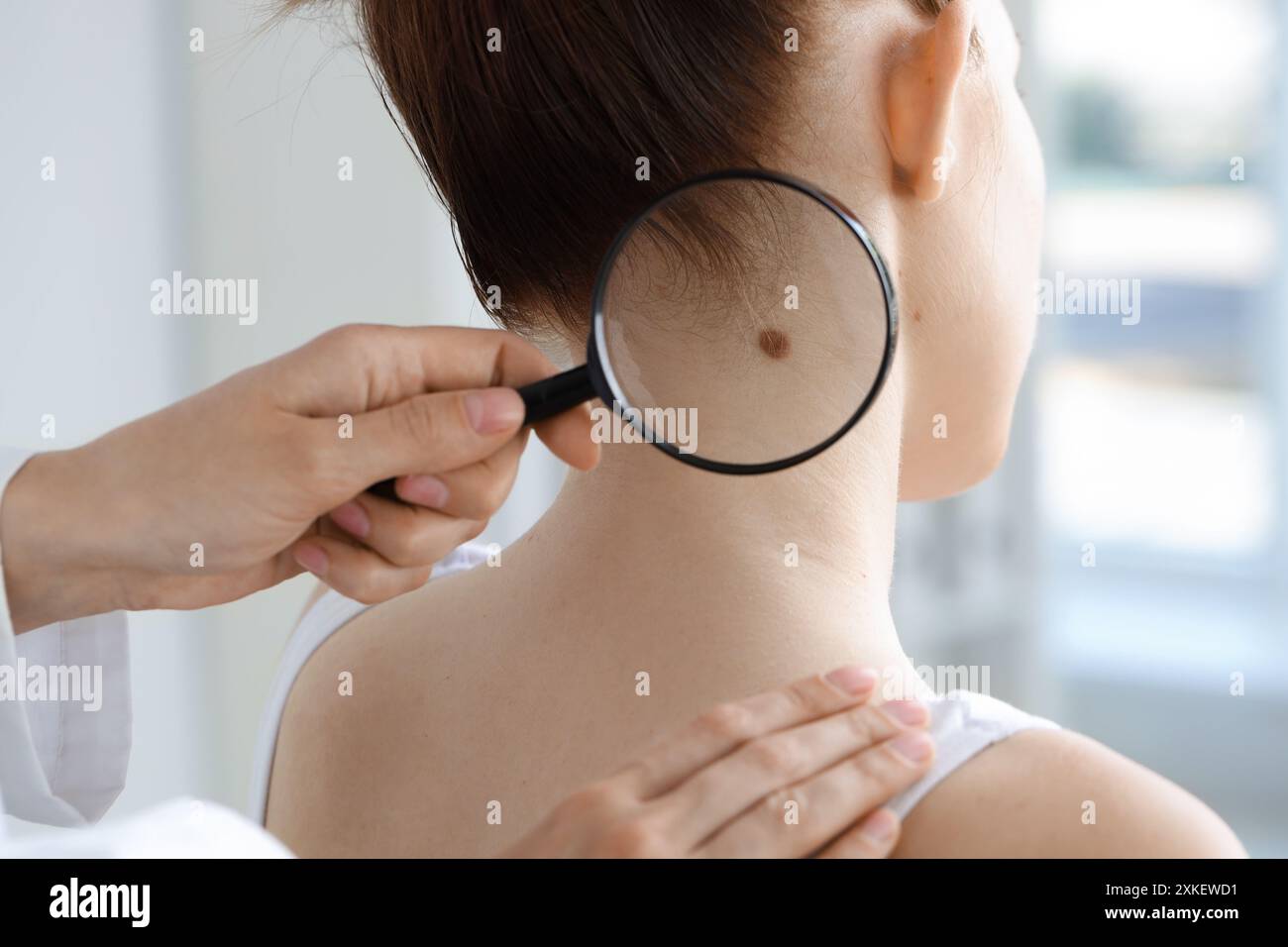 Doctor examining woman's mole with magnifying glass in clinic, closeup ...