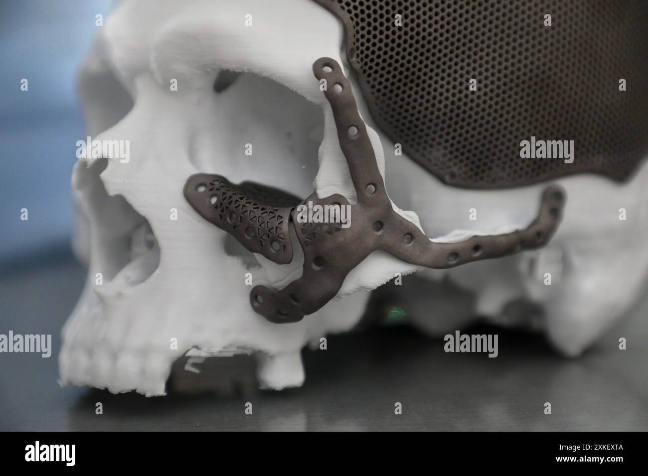 3d printed bones hi-res stock photography and images - Alamy