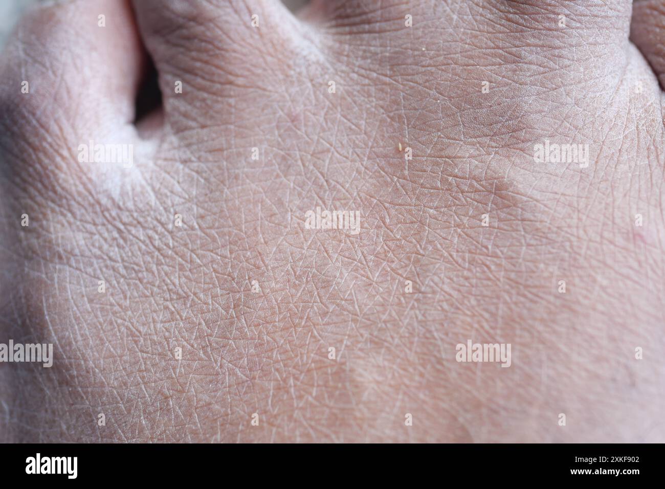 Closeup view woman normal hi-res stock photography and images - Alamy