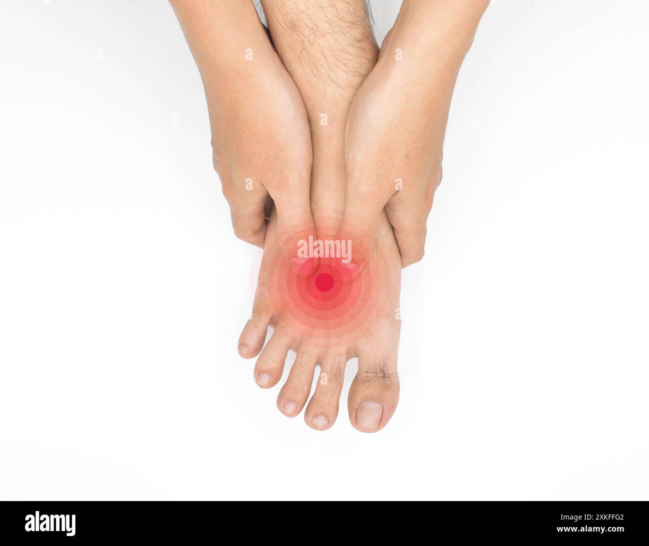 Painful foot of Asian young man with diabetes. Sensory neuropathy ...
