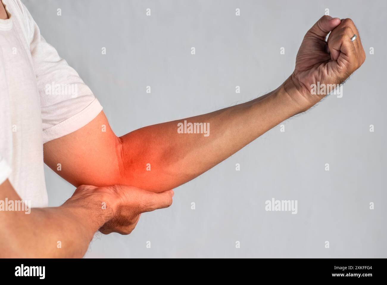 Elbow Cellulitis Icd 10