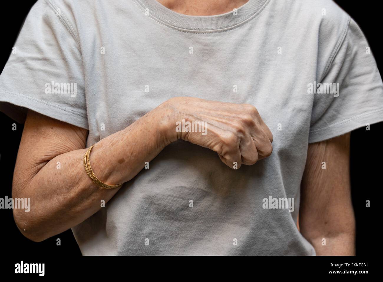 Joints of upper limb hi-res stock photography and images - Alamy