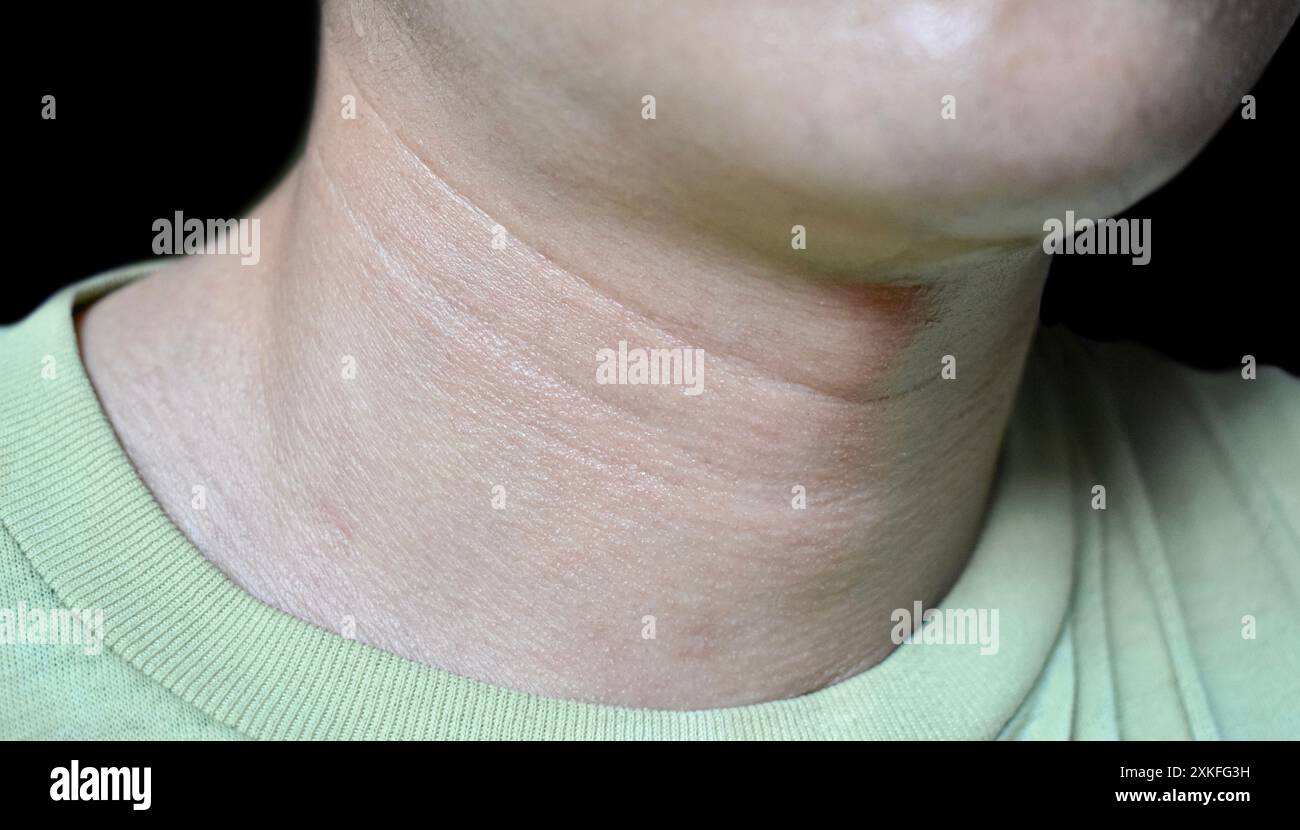 Crease neck hi-res stock photography and images - Alamy