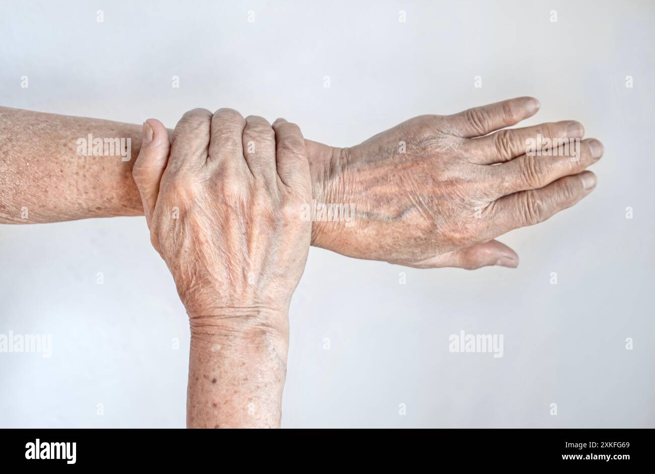 Aging hands of Asian elder woman. Concept of rheumatoid arthritis ...
