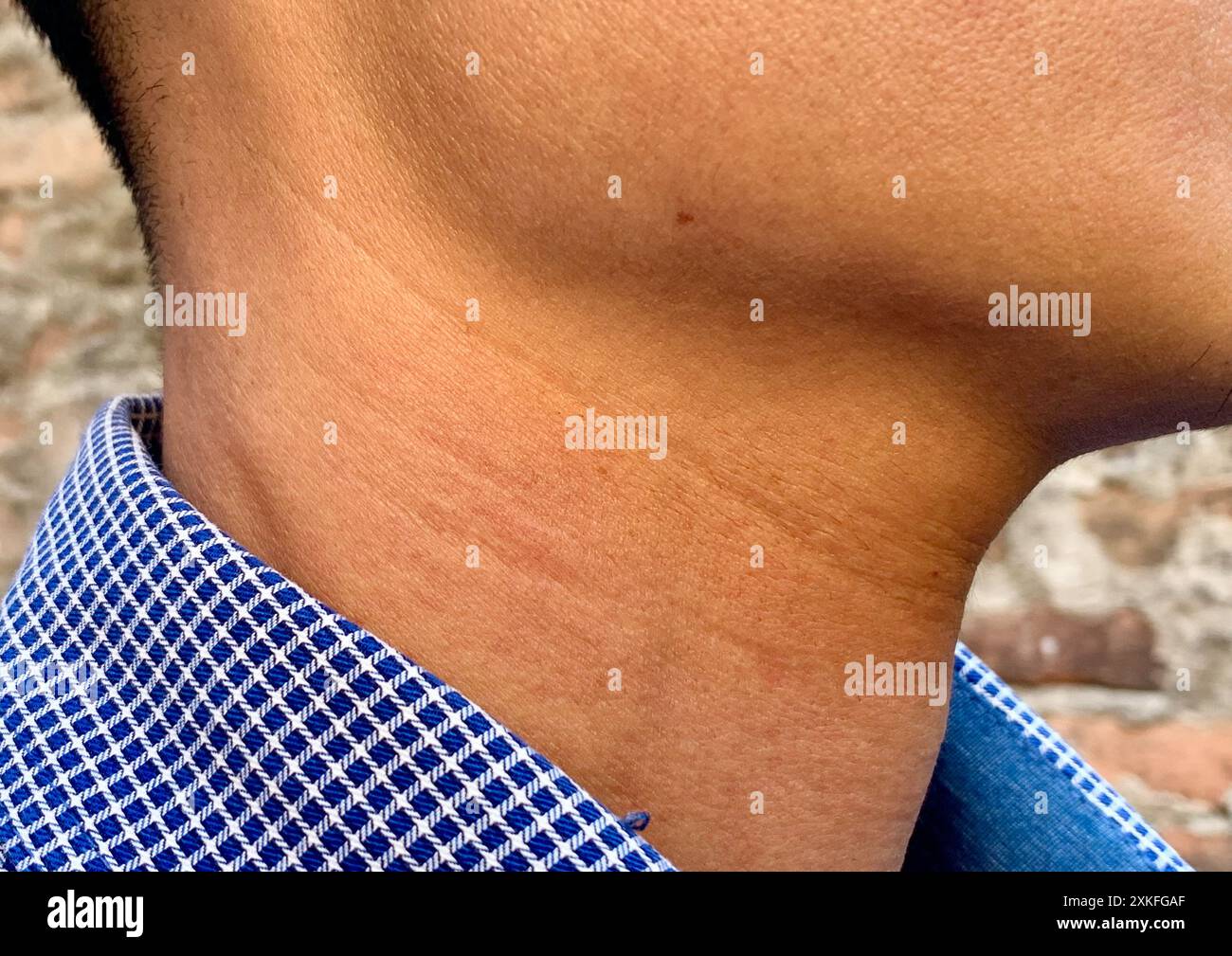 Aging skin folds or skin creases or wrinkles at neck of Southeast Asian ...