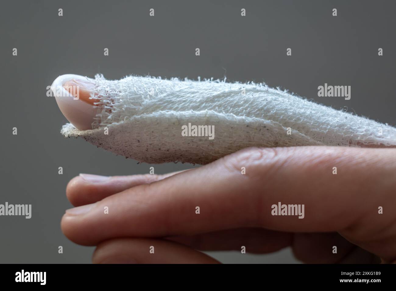 Mallet finger splint hi-res stock photography and images - Alamy