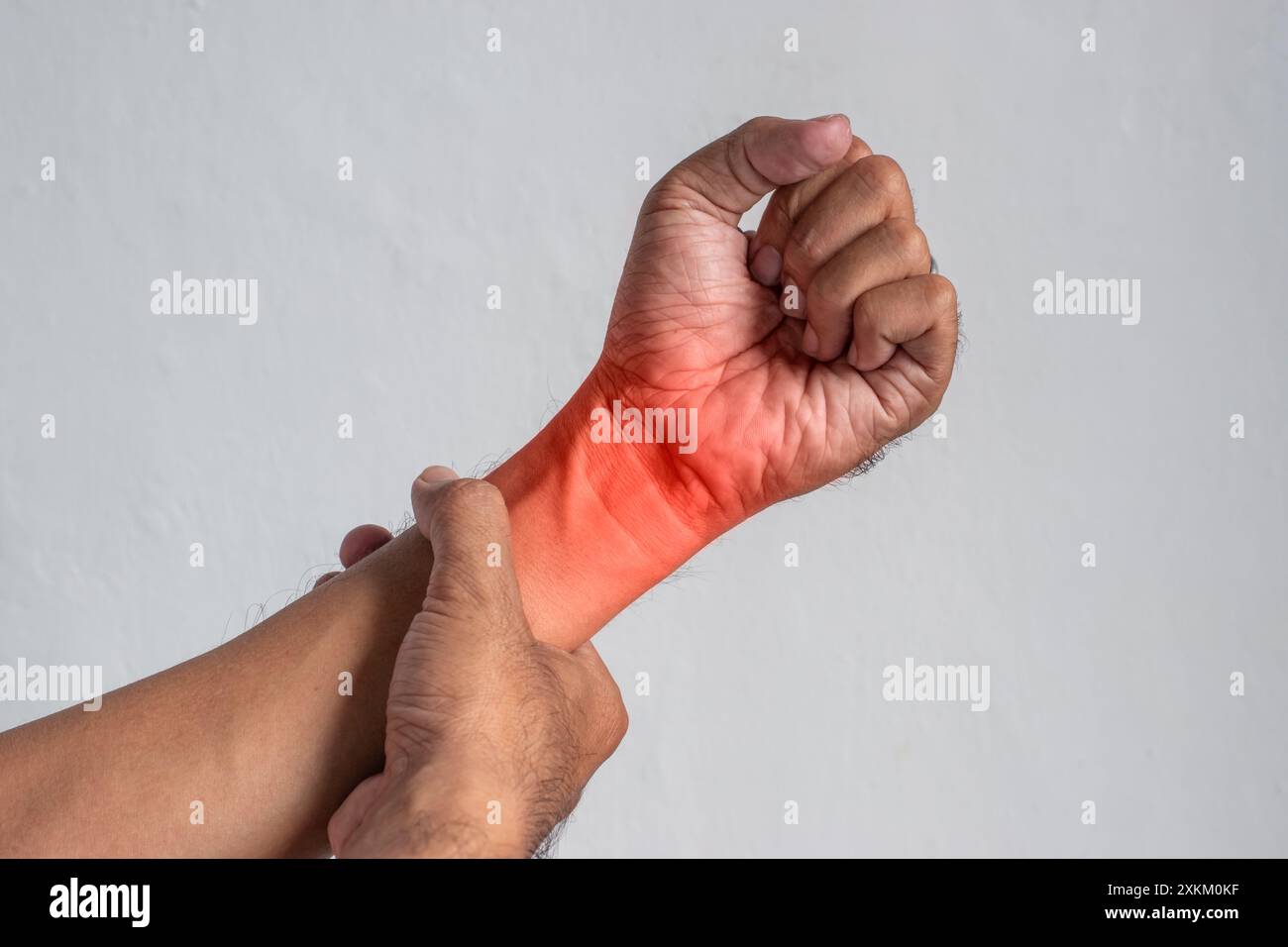 Inflammation of wrist joint. Concept of joint pain, arthritis ...