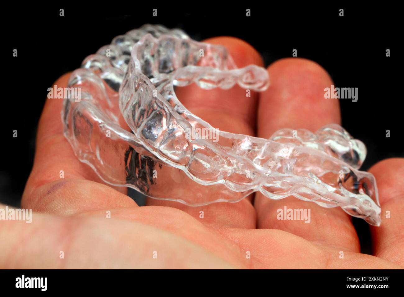 new plastic braces in the human hand Stock Photo - Alamy