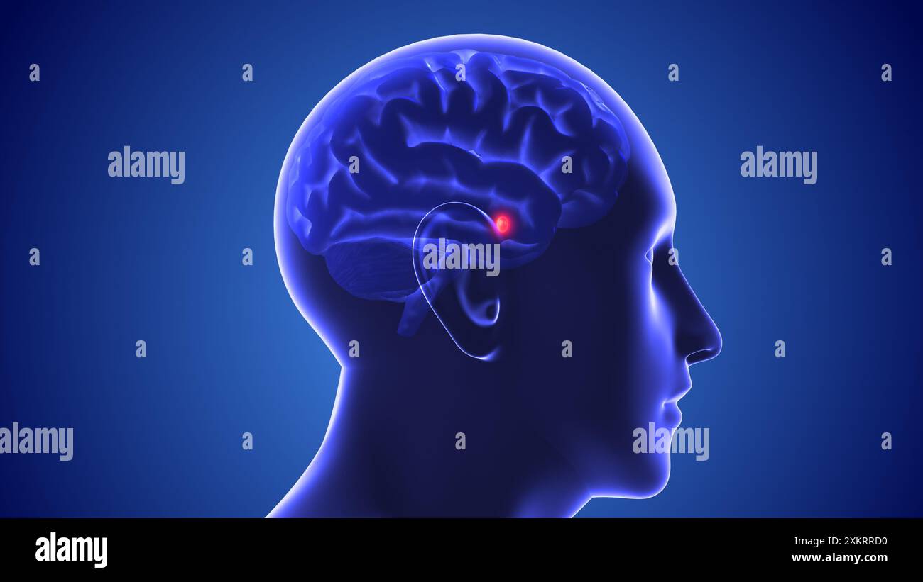 Autism spectrum syndrome hi-res stock photography and images - Alamy