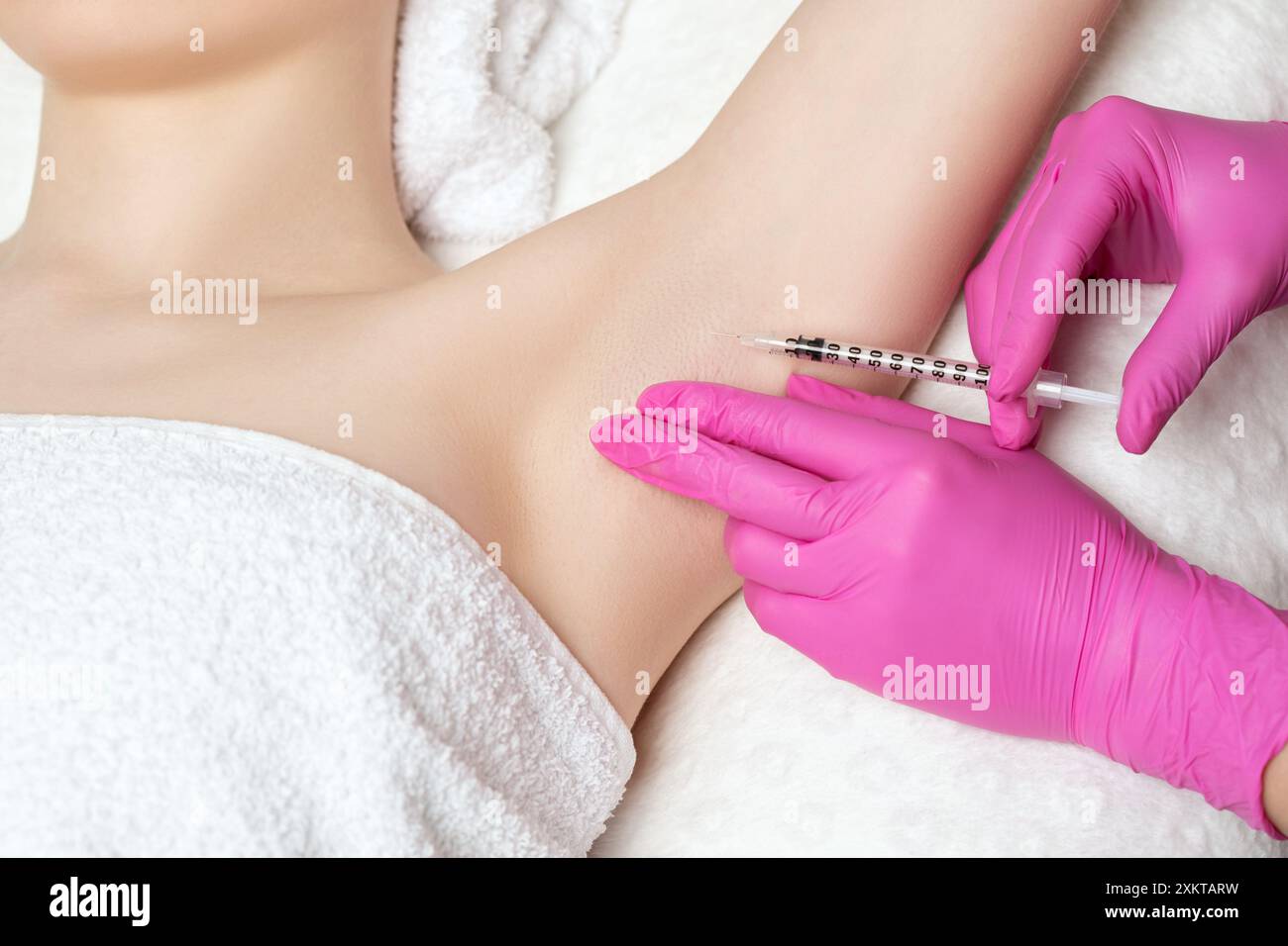 The doctor makes injections of botulinum toxin in the underarm area ...