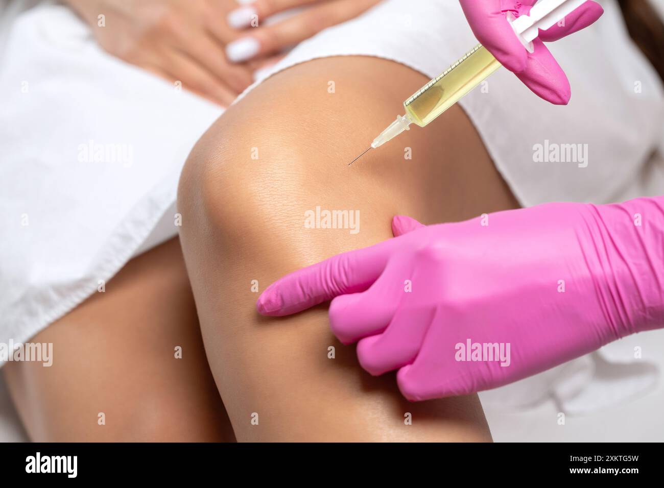 Doctor doing stem cell therapy on a patient's knee after the injury. Treating knee pain with ...