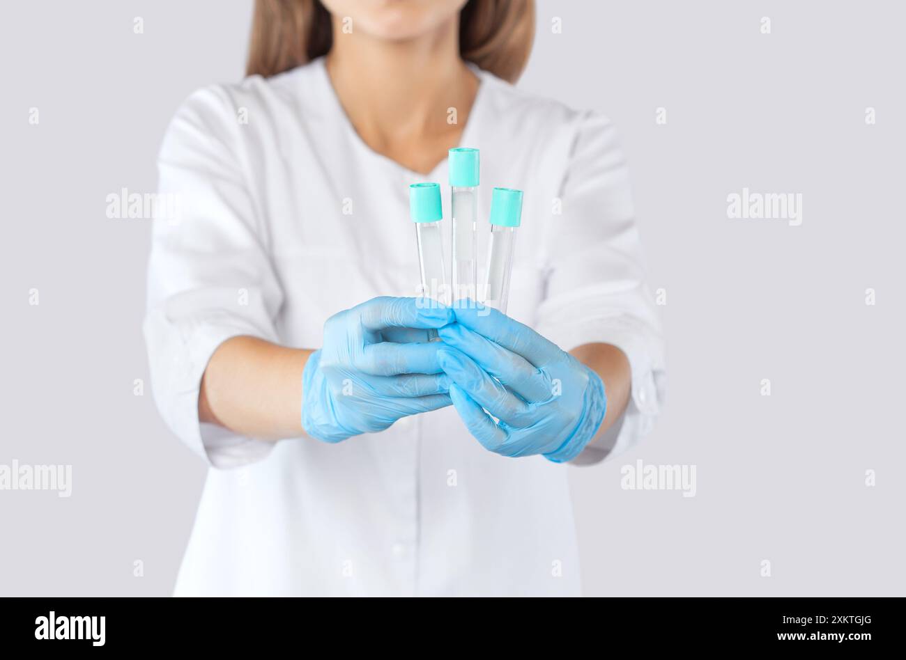 The doctor holds three tubes for collecting blood in his hands. Prp ...