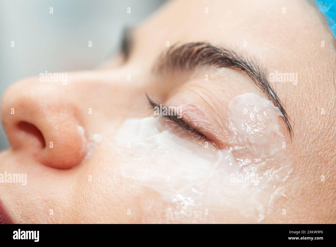 Topical anesthesia hi-res stock photography and images - Alamy