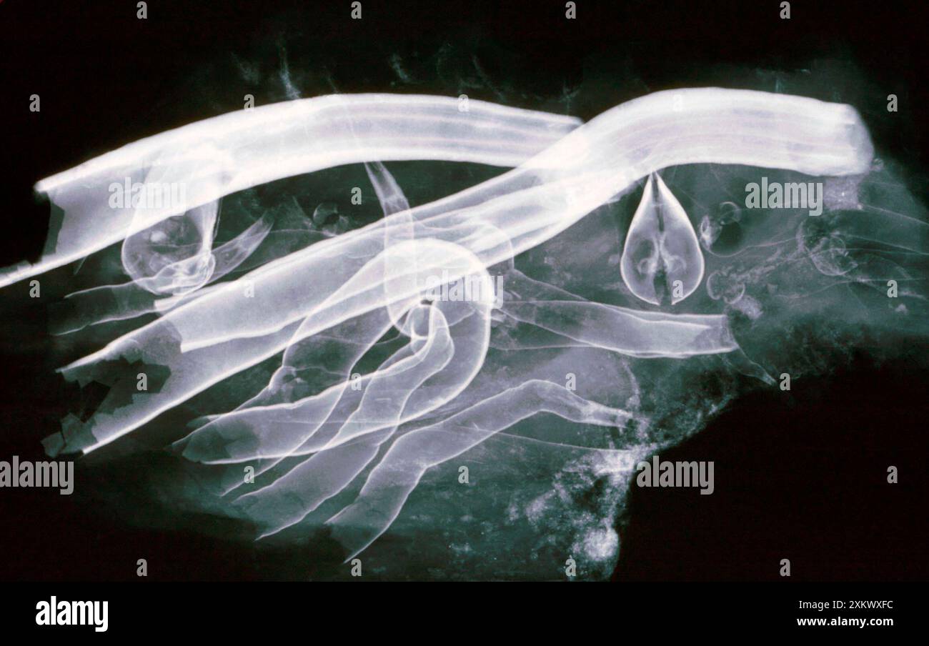 Shipworm - xray showing calcium lined burrows in Stock Photo - Alamy