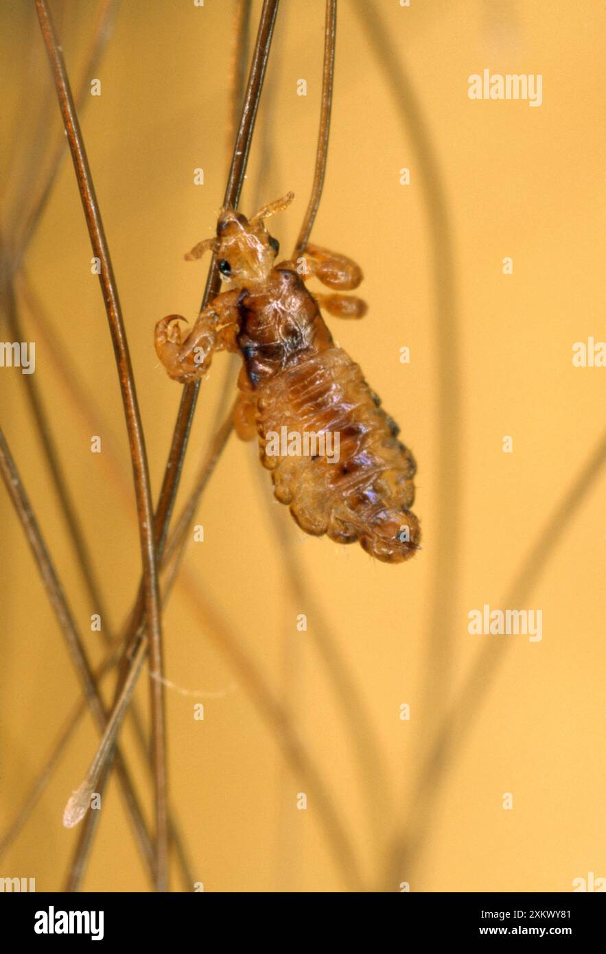 Human parasites hi-res stock photography and images - Alamy