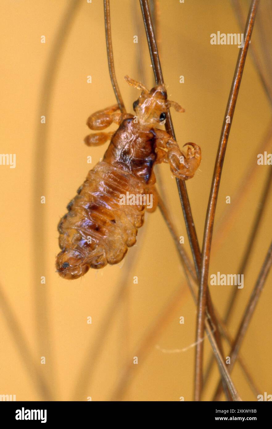 Hair parasites hi-res stock photography and images - Alamy