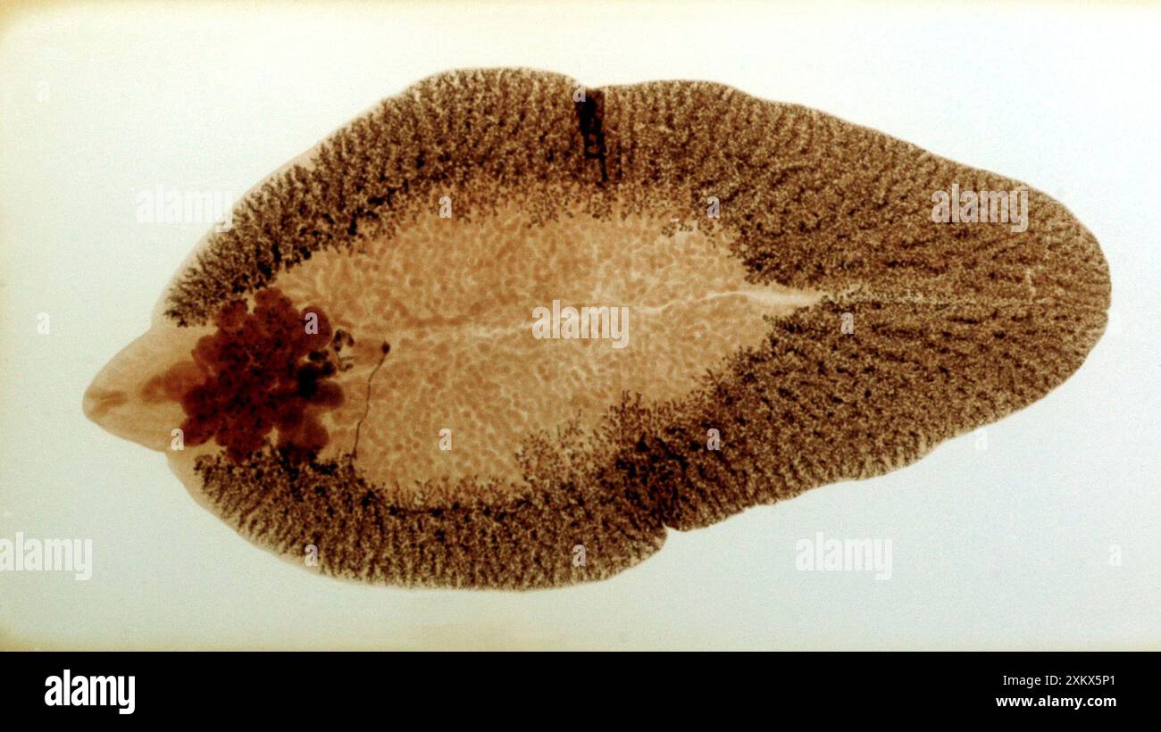Liver Fluke, microscope slide preparation of the Stock Photo - Alamy