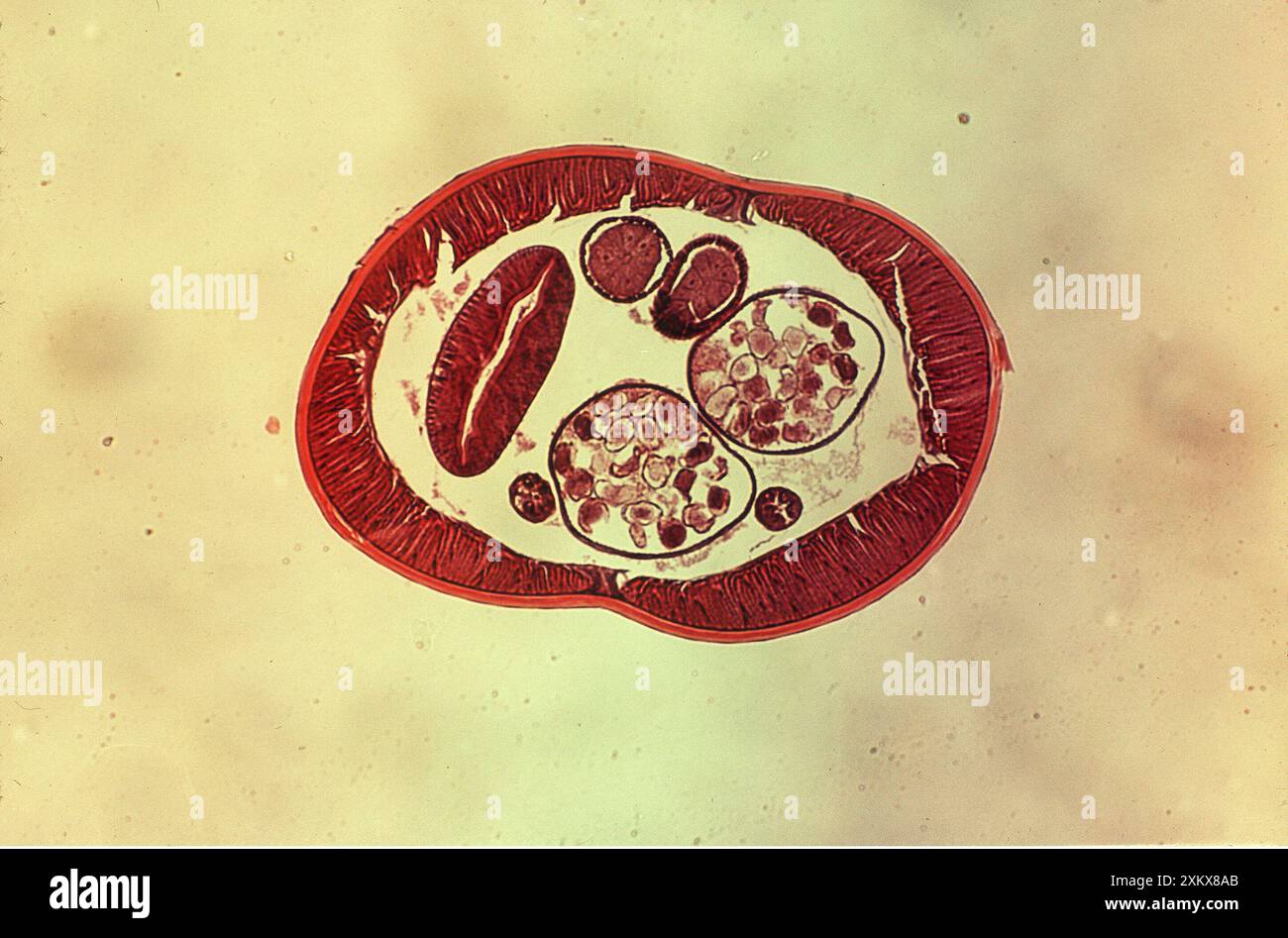 Cat roundworm - cross section Toxascaris - X 15 Stock Photo - Alamy