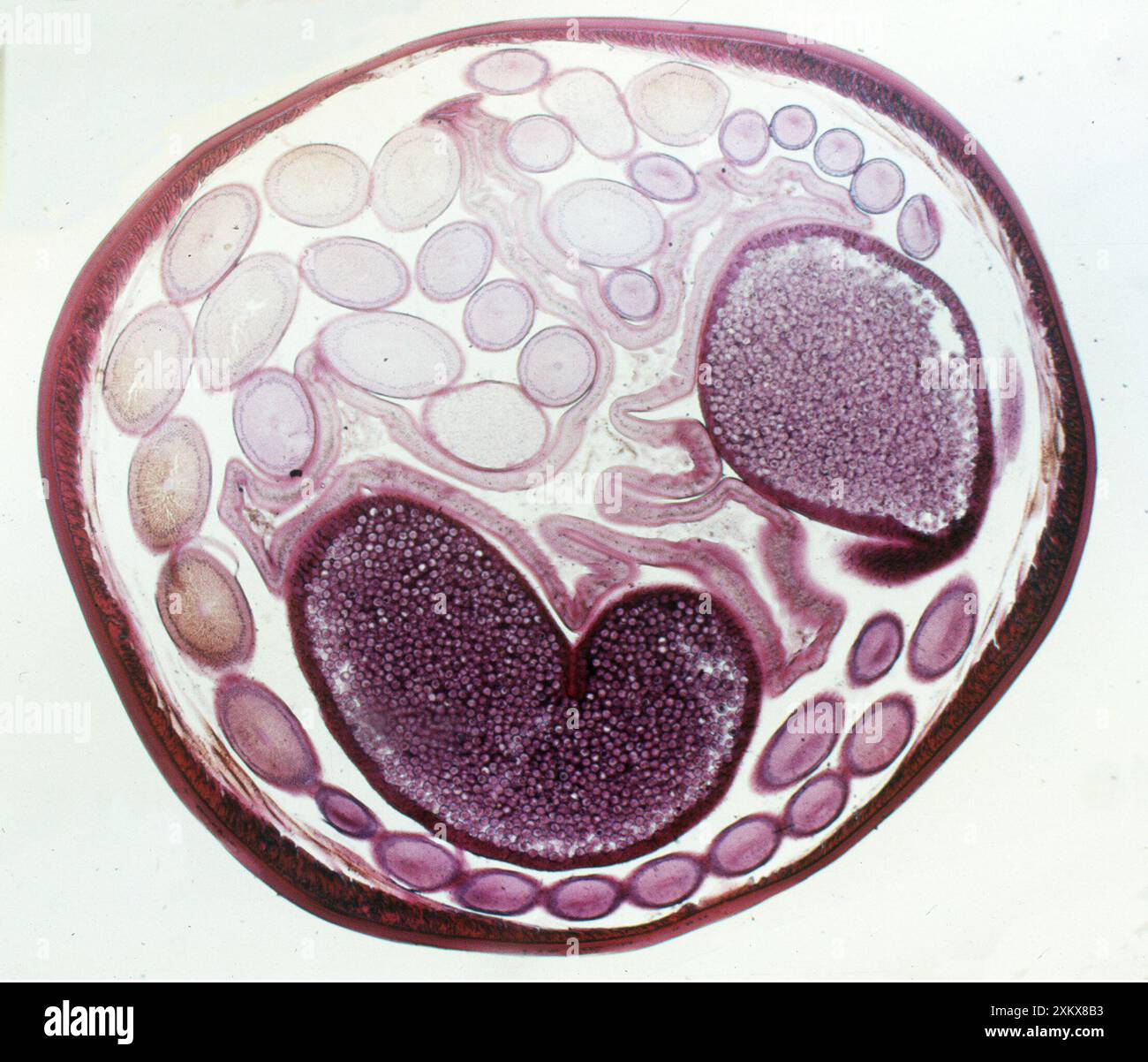 Roundworm hi-res stock photography and images - Alamy