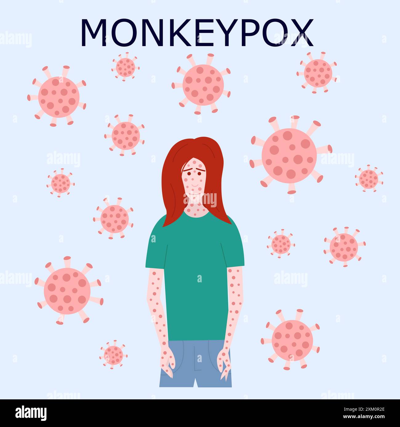 Monkey pox outbreak Stock Vector Image & Art - Alamy