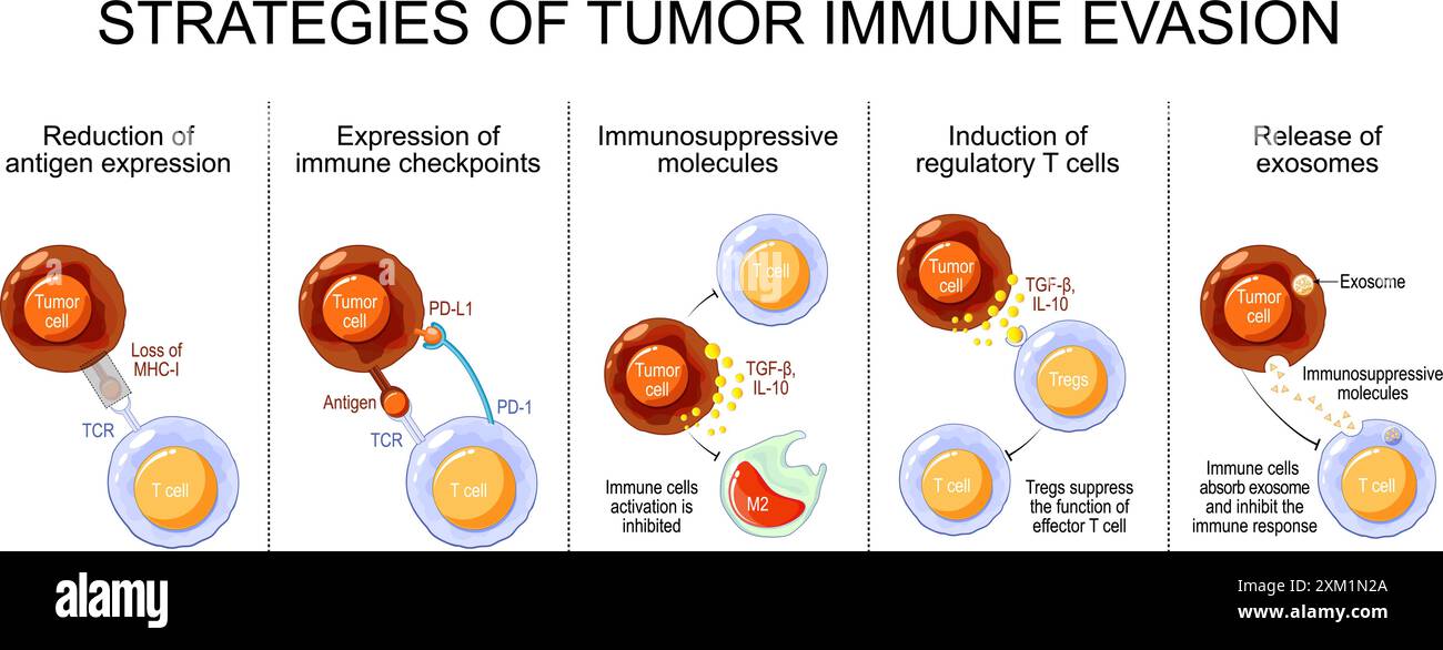 Tumor associated Stock Vector Images - Alamy