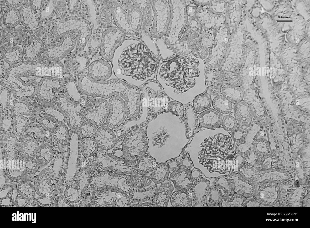 longitudinal section of kidney cells under a light microscope, in black and white Stock Photo ...