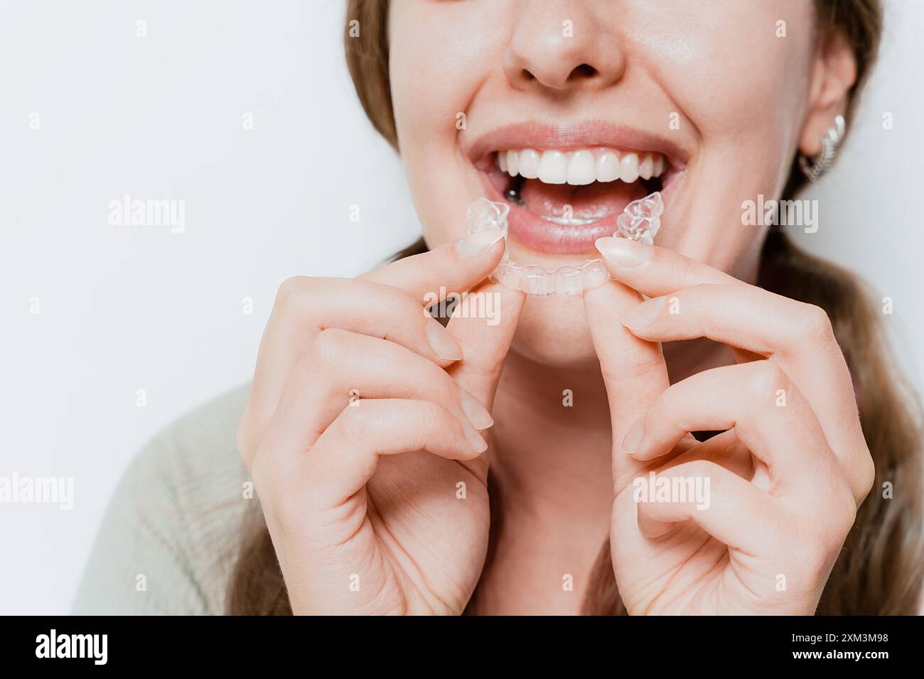 Smiling woman with a snow-white smile demonstrate clear teeth aligner ...
