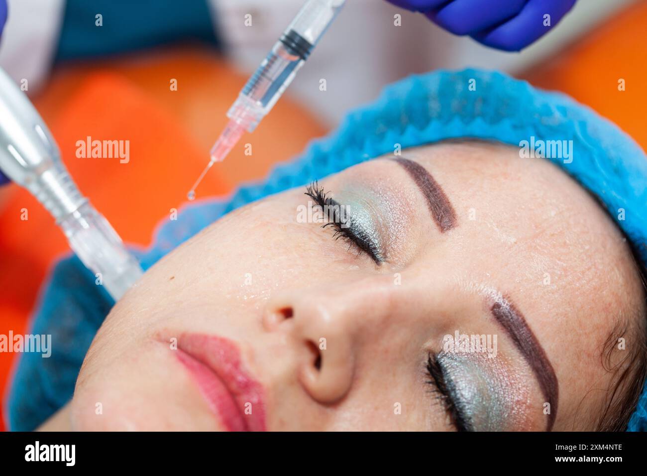 Application of an anti-aging facial rejuvenation cocktail using micro ...