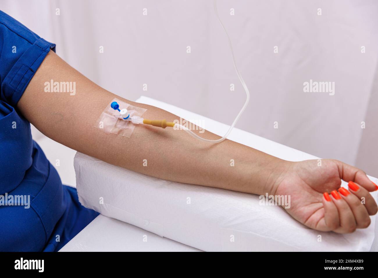 Arm of The patient while receiving an intravenous saline drip to ...