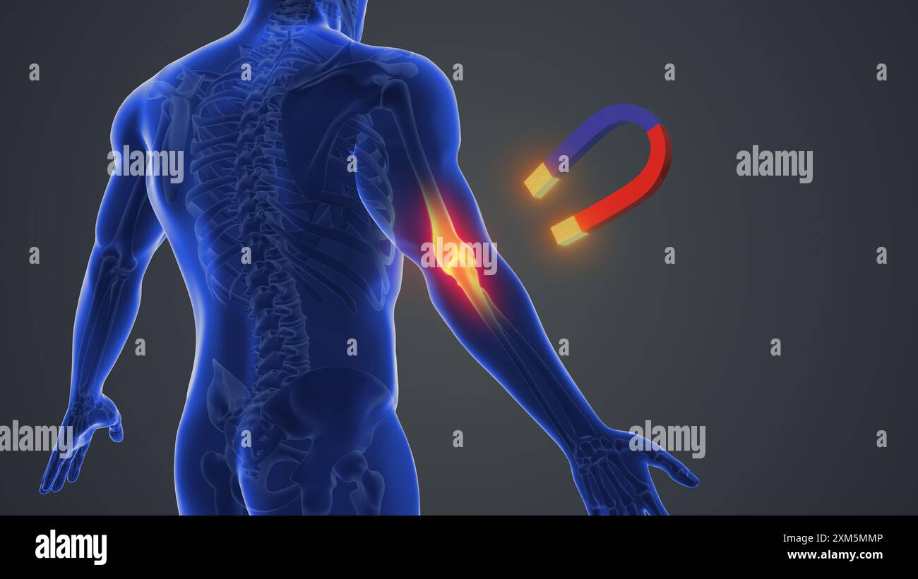 Magnetic field therapy hi-res stock photography and images - Alamy