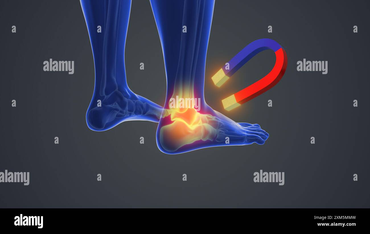 Magnet therapy for feet joint pain Stock Photo - Alamy